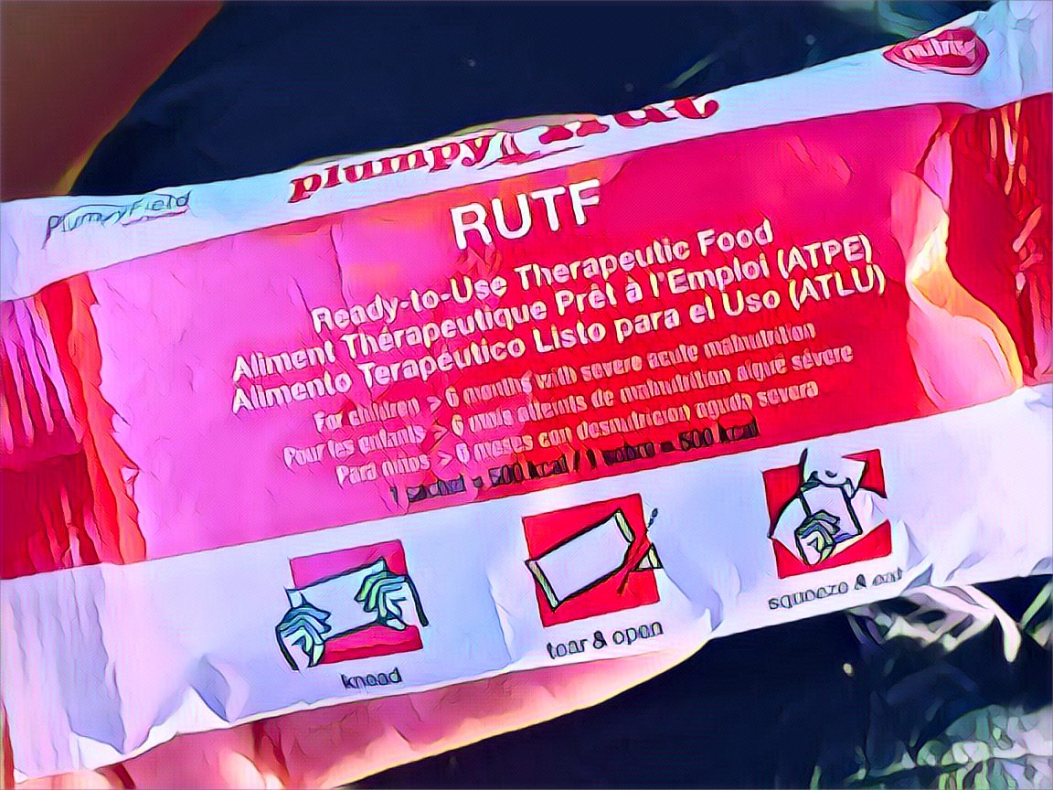 Plumpy Nuts Shortage Threatens Malnourished Children in Ghana - The ...